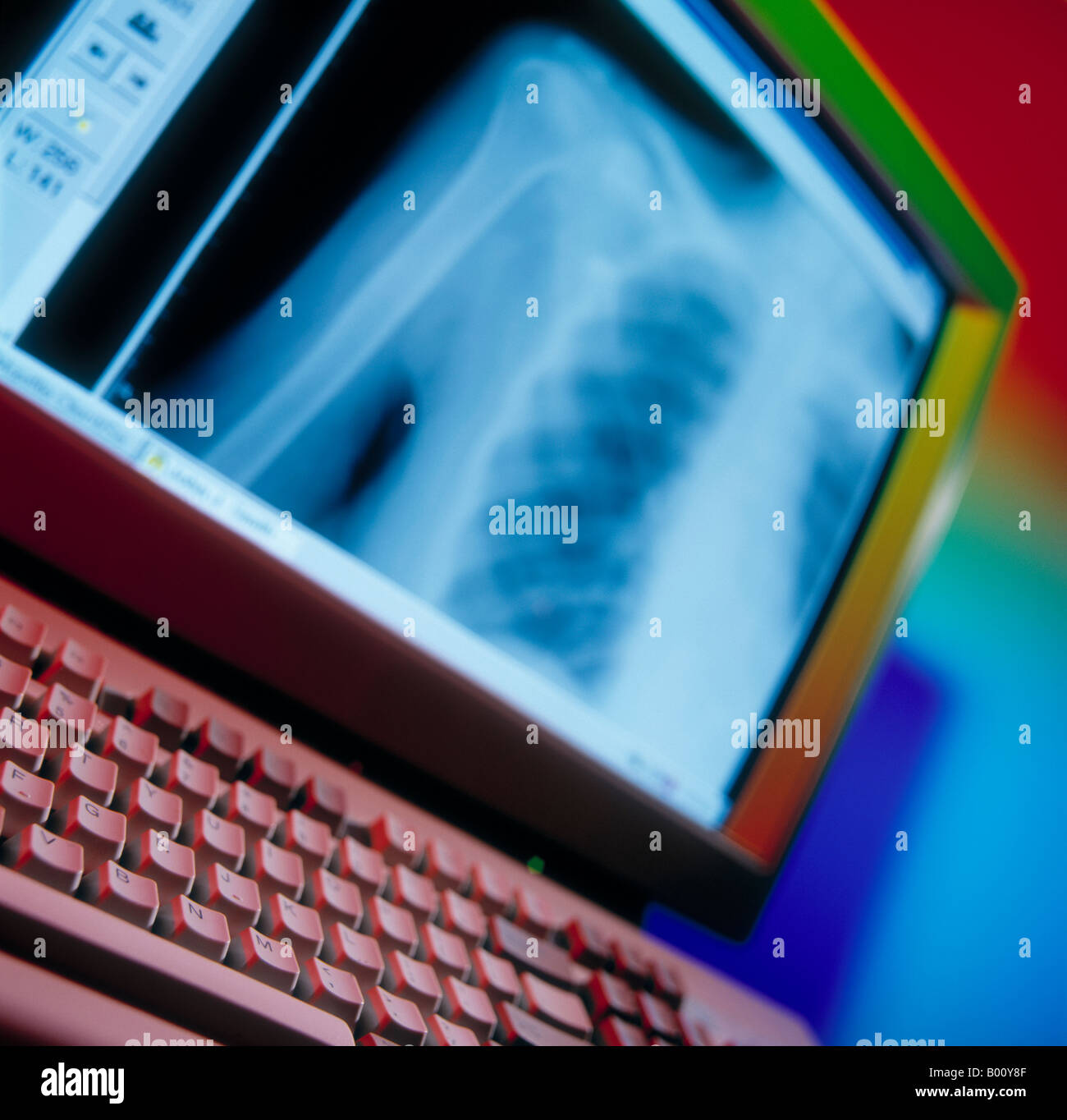 Chest x ray displayed on computer screen with impact colors Down low ...