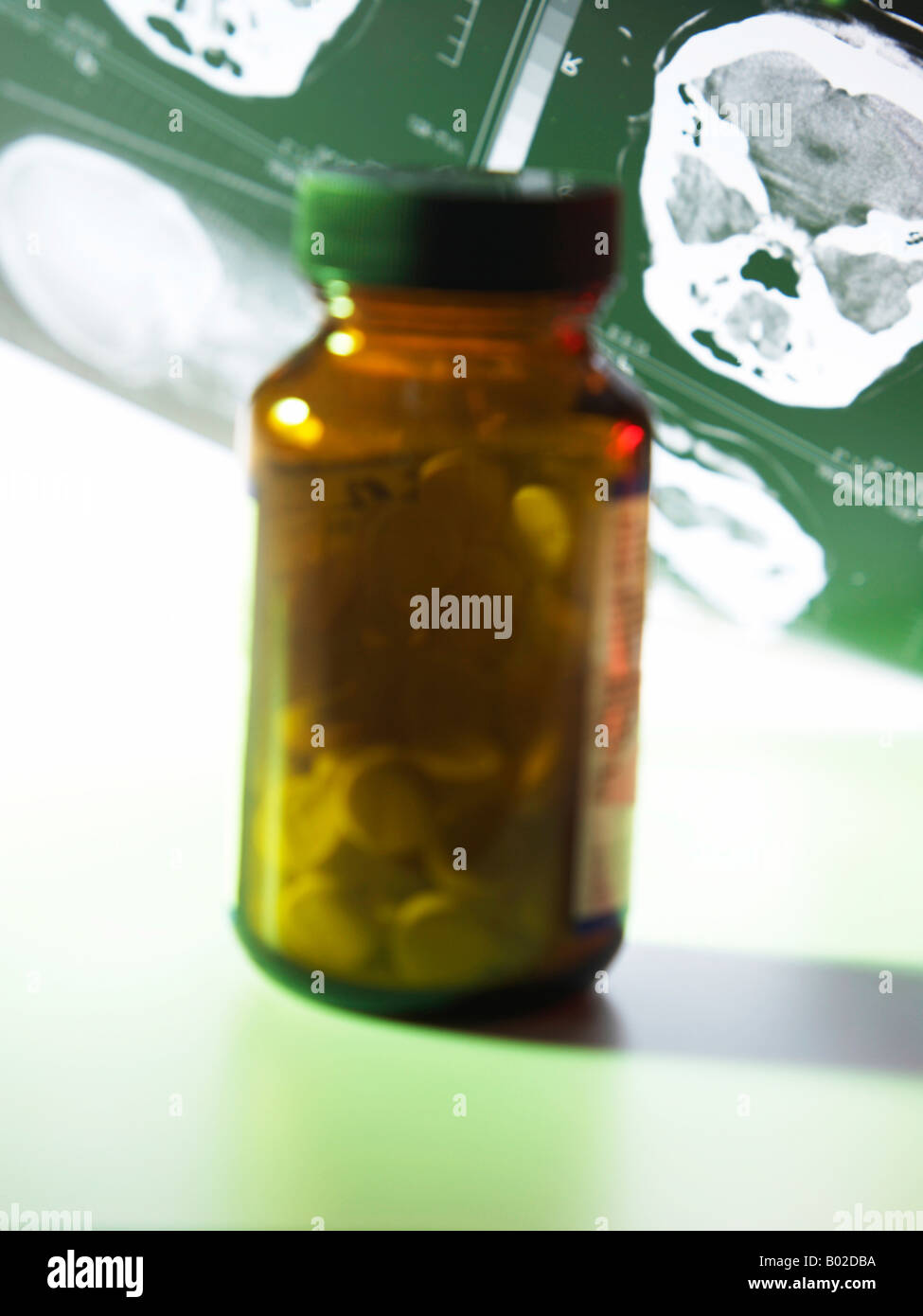 A bottle with skull x ray on background Stock Photo - Alamy