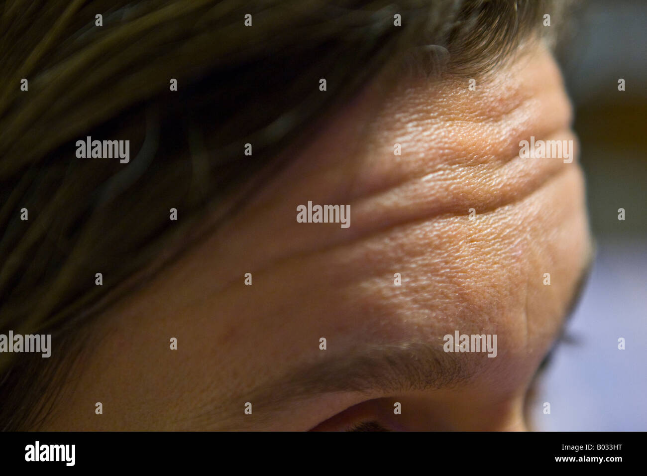 close up forehead wrinkles woman skin Stock Photo - Alamy