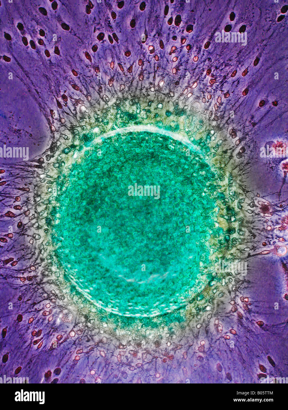 human sperm cells fertilizing egg ovum Stock Photo - Alamy