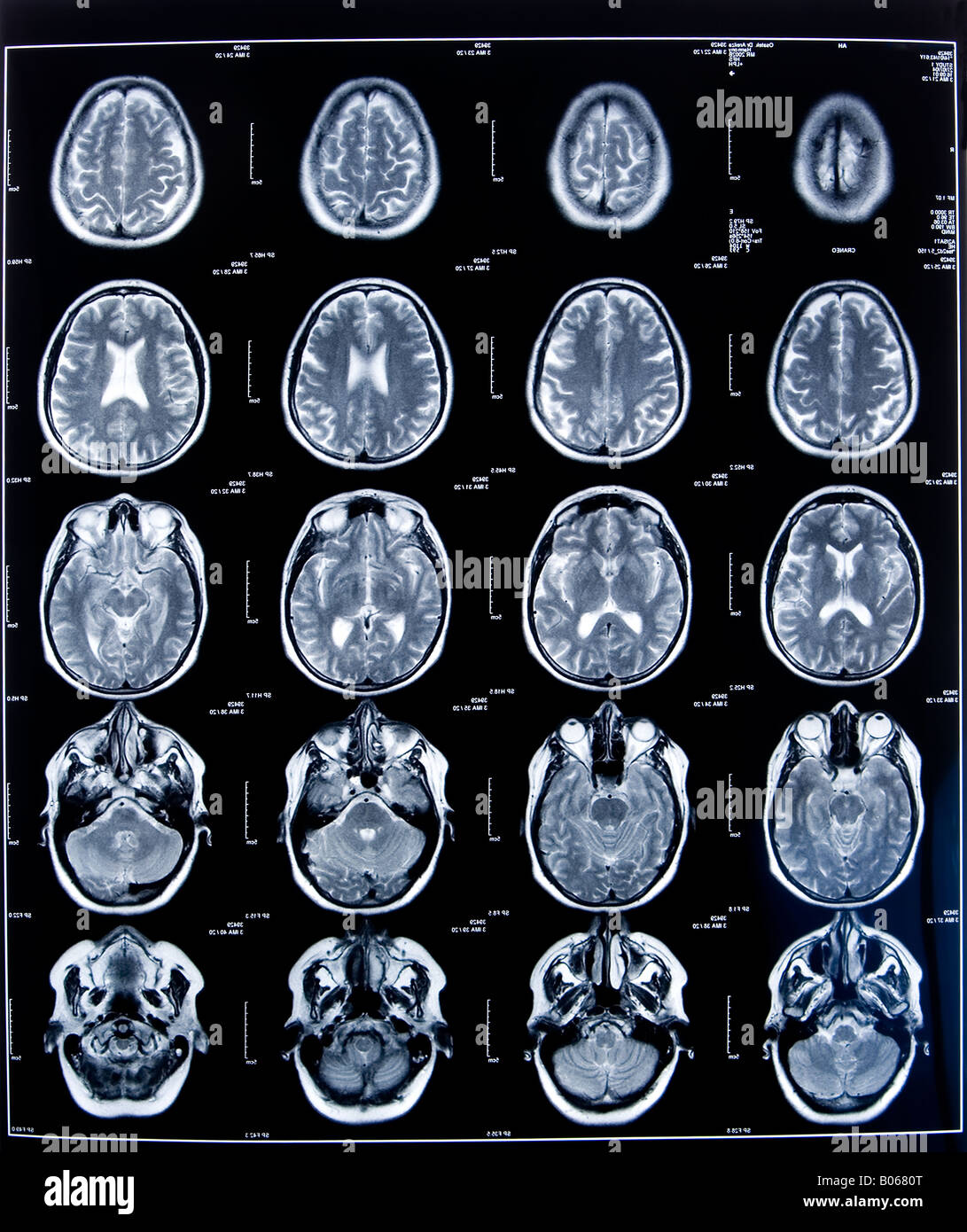 health medical image of an mri of the head showing the brain Stock ...