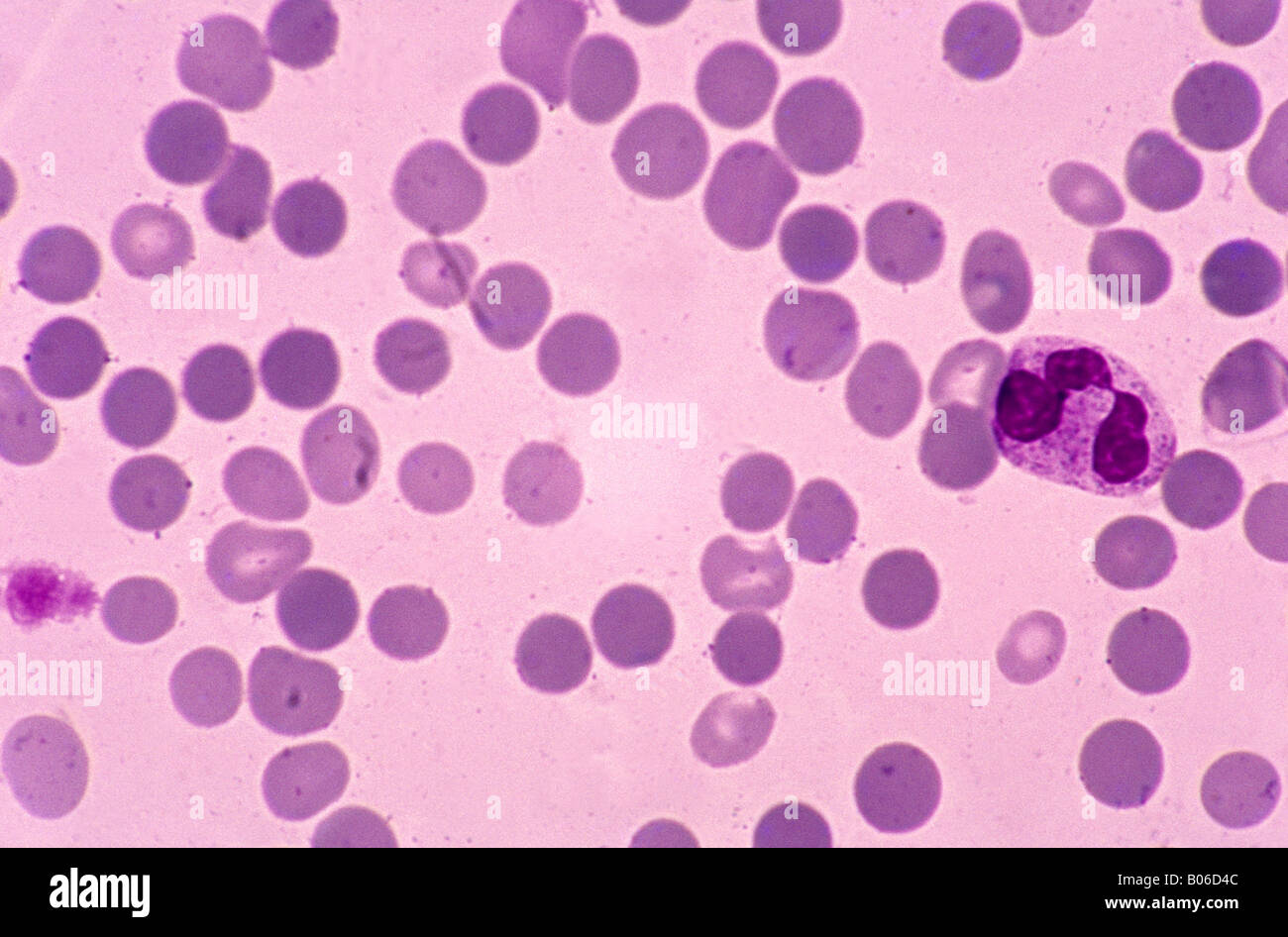 Red blood cell light micrograph hi-res stock photography and images - Alamy