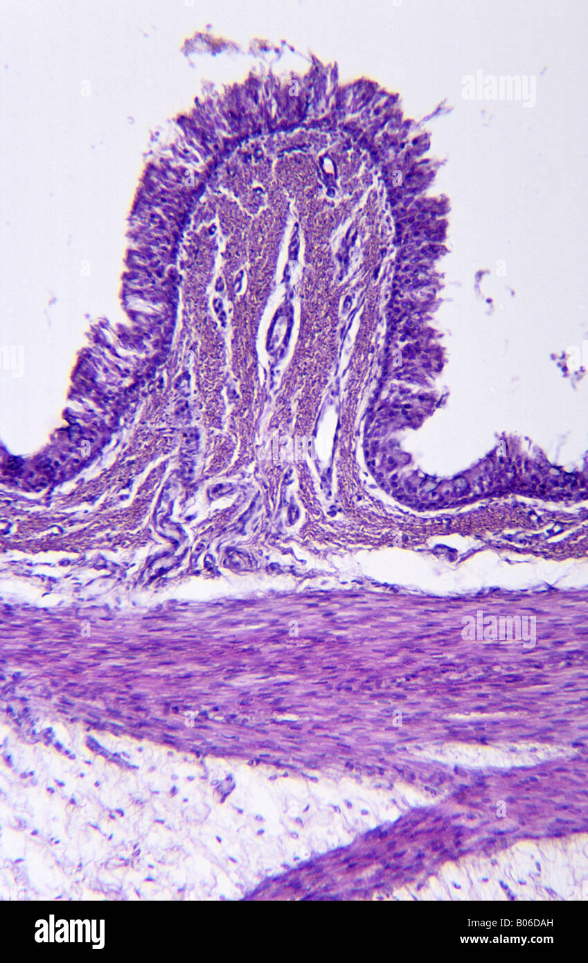 Cilia micrograph hi-res stock photography and images - Alamy