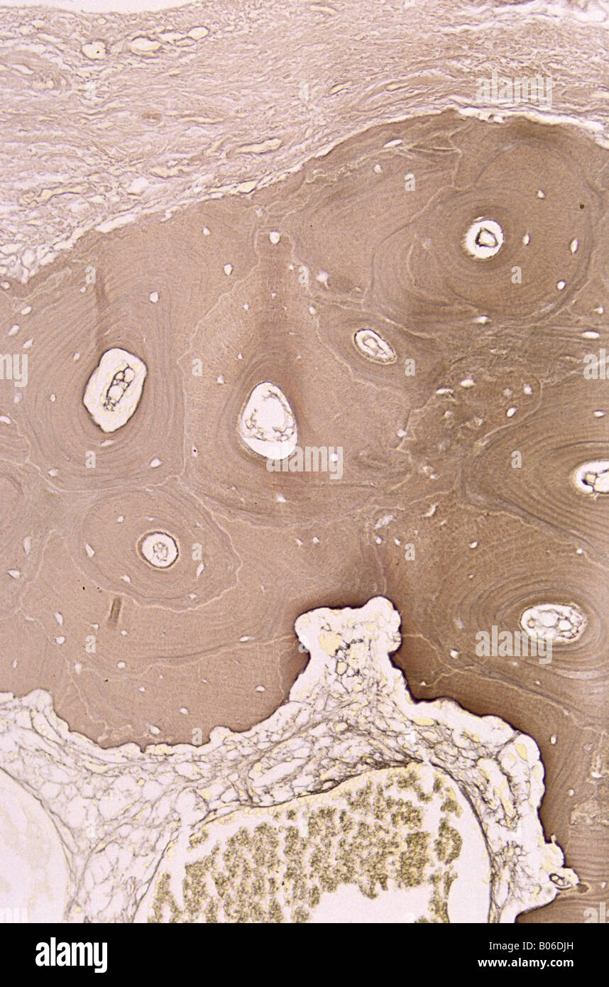 Histology of osteon hi-res stock photography and images - Alamy