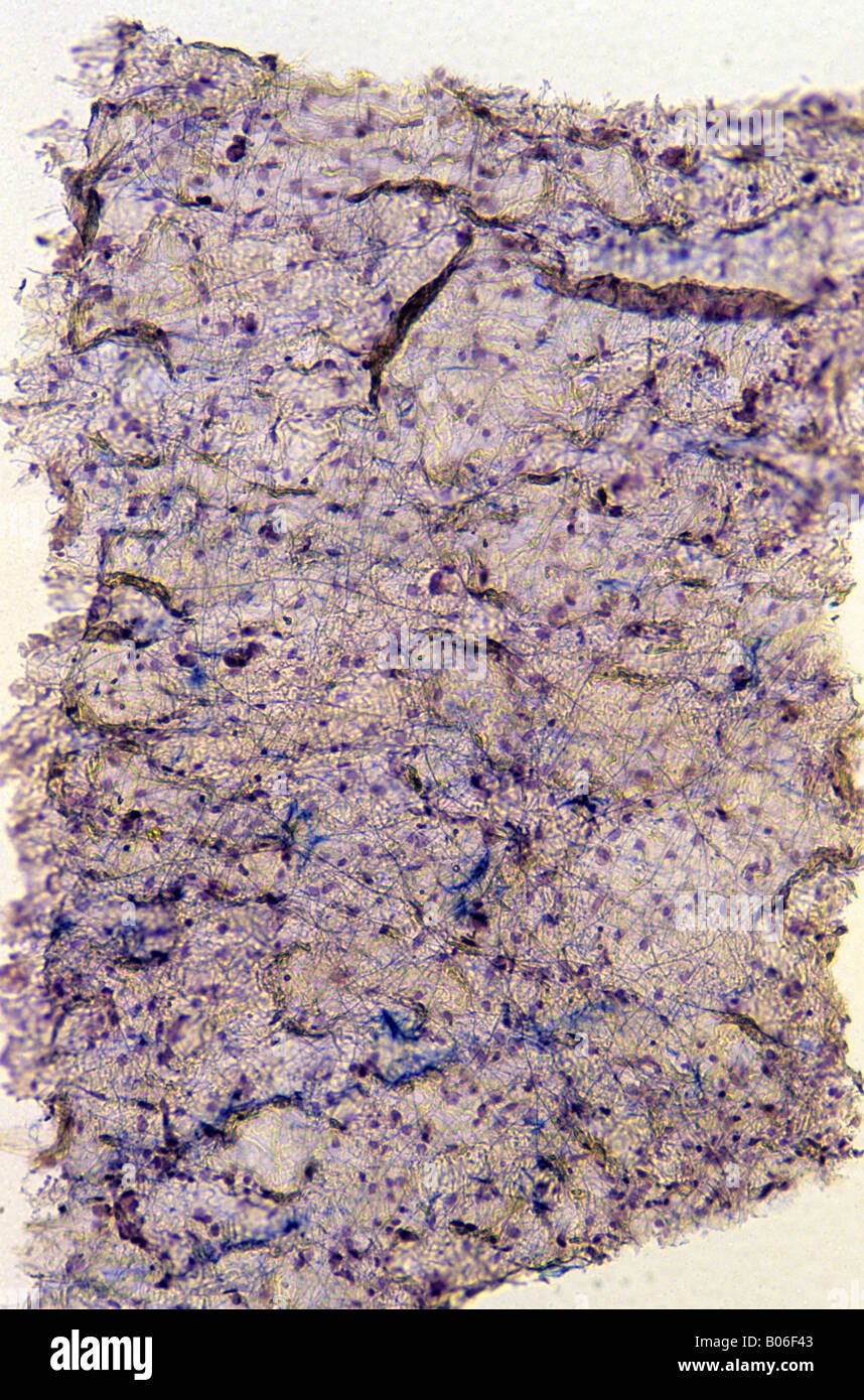 Connective tissue with collagen fibers hi-res stock photography and ...
