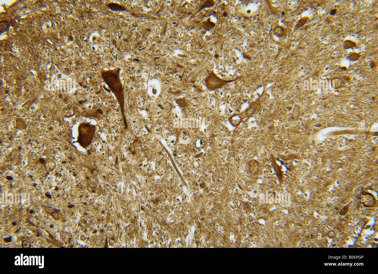 Nerve cell micrograph hi-res stock photography and images - Alamy