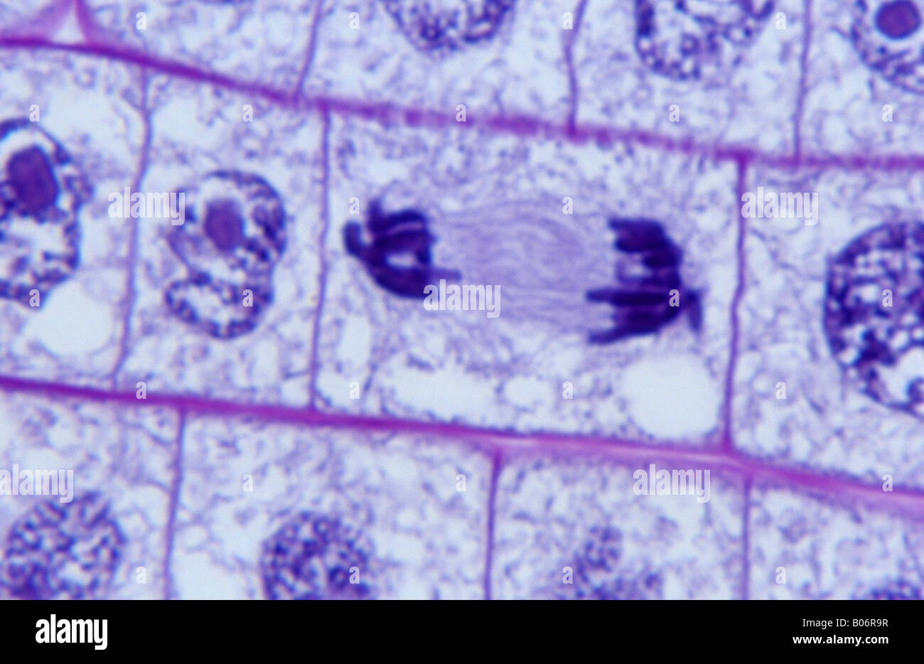 Onion mitosis root tip Stock Photo - Alamy