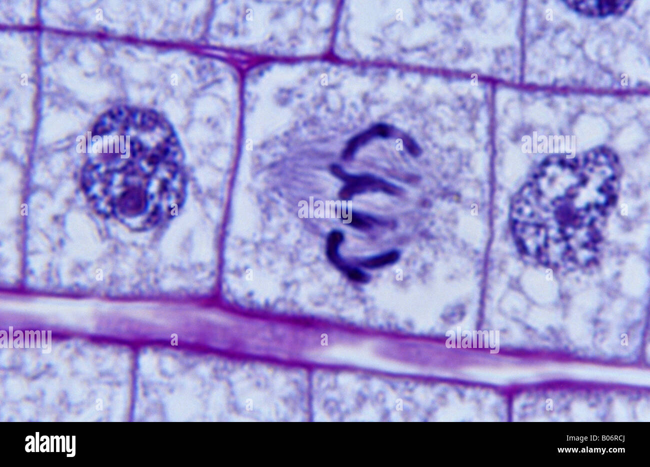 Mitosis onion hi-res stock photography and images - Alamy