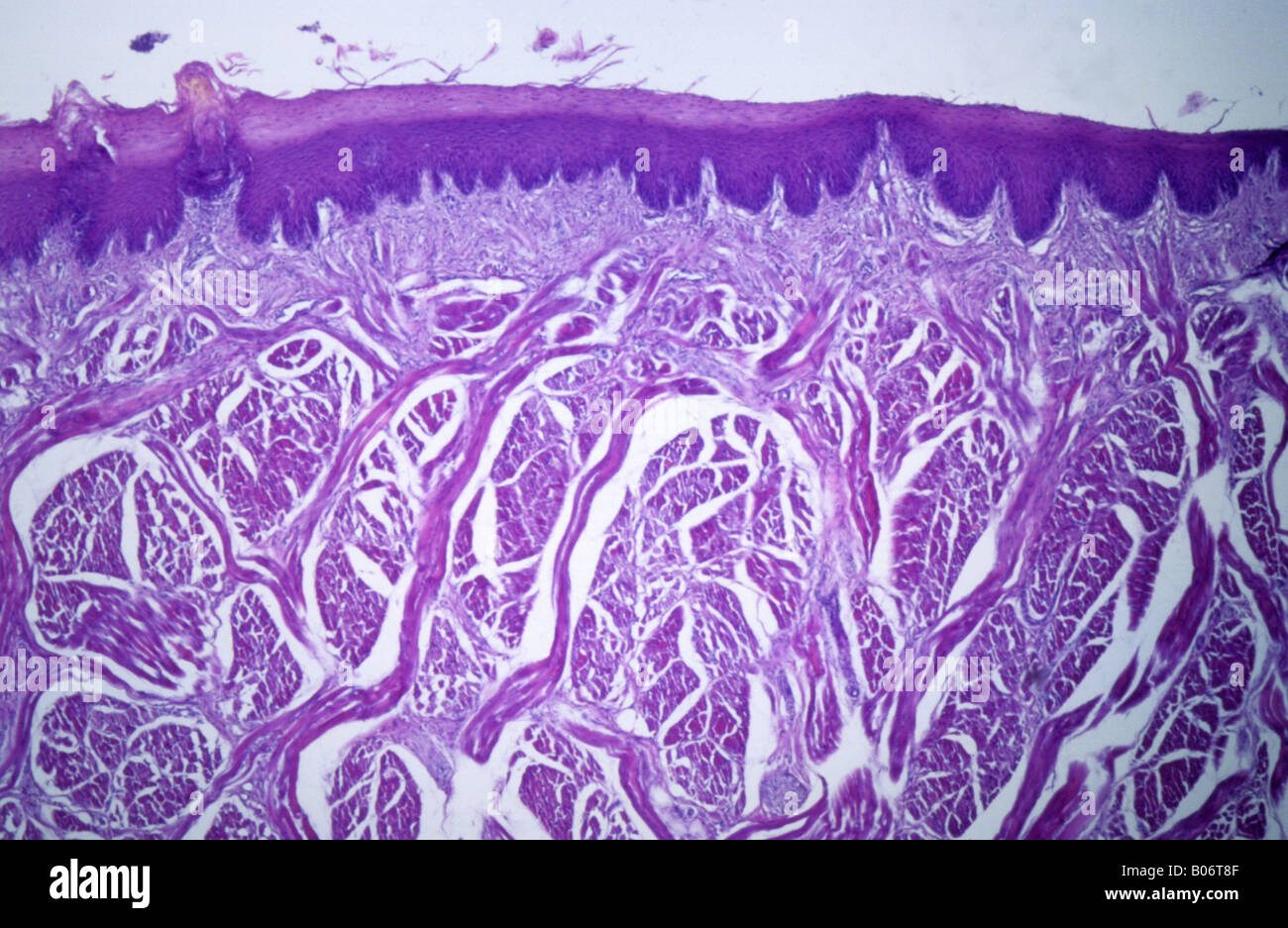 Epithelial tissue hi-res stock photography and images - Alamy
