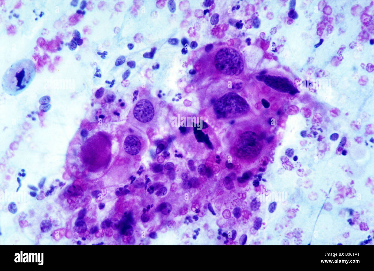 Microscope slide preparation hi-res stock photography and images - Alamy