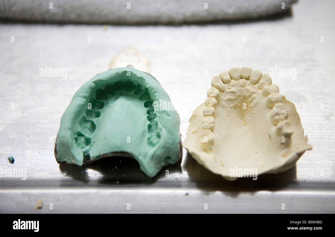 Dental molds hi-res stock photography and images - Alamy