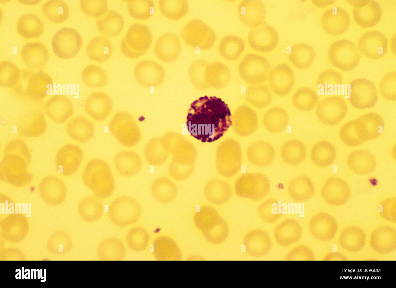 Red blood cell light micrograph hi-res stock photography and images - Alamy