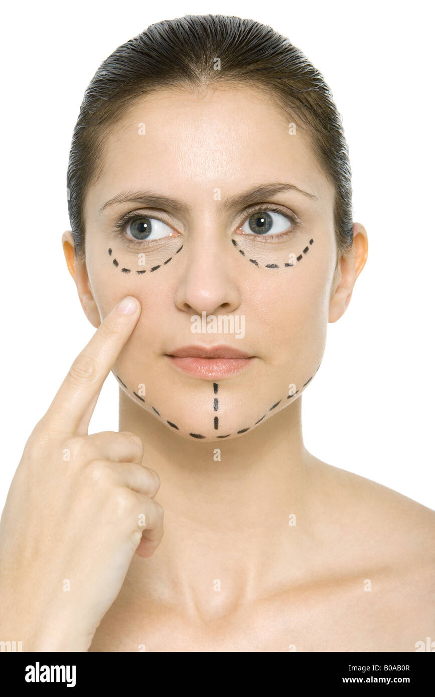 Woman with plastic surgery markings on face, pointing at cheek, looking ...