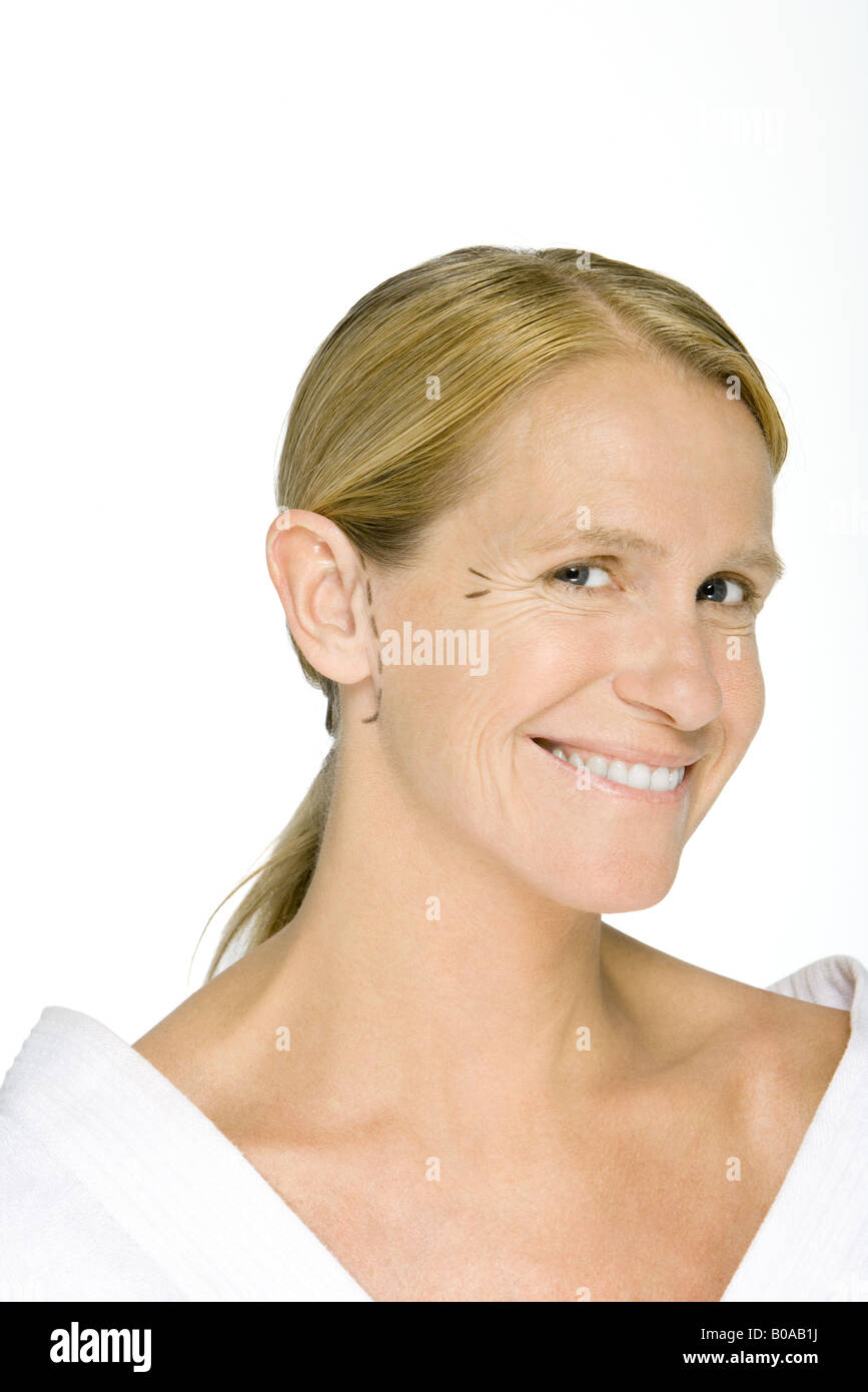 Woman with plastic surgery markings on face, smiling at camera Stock ...