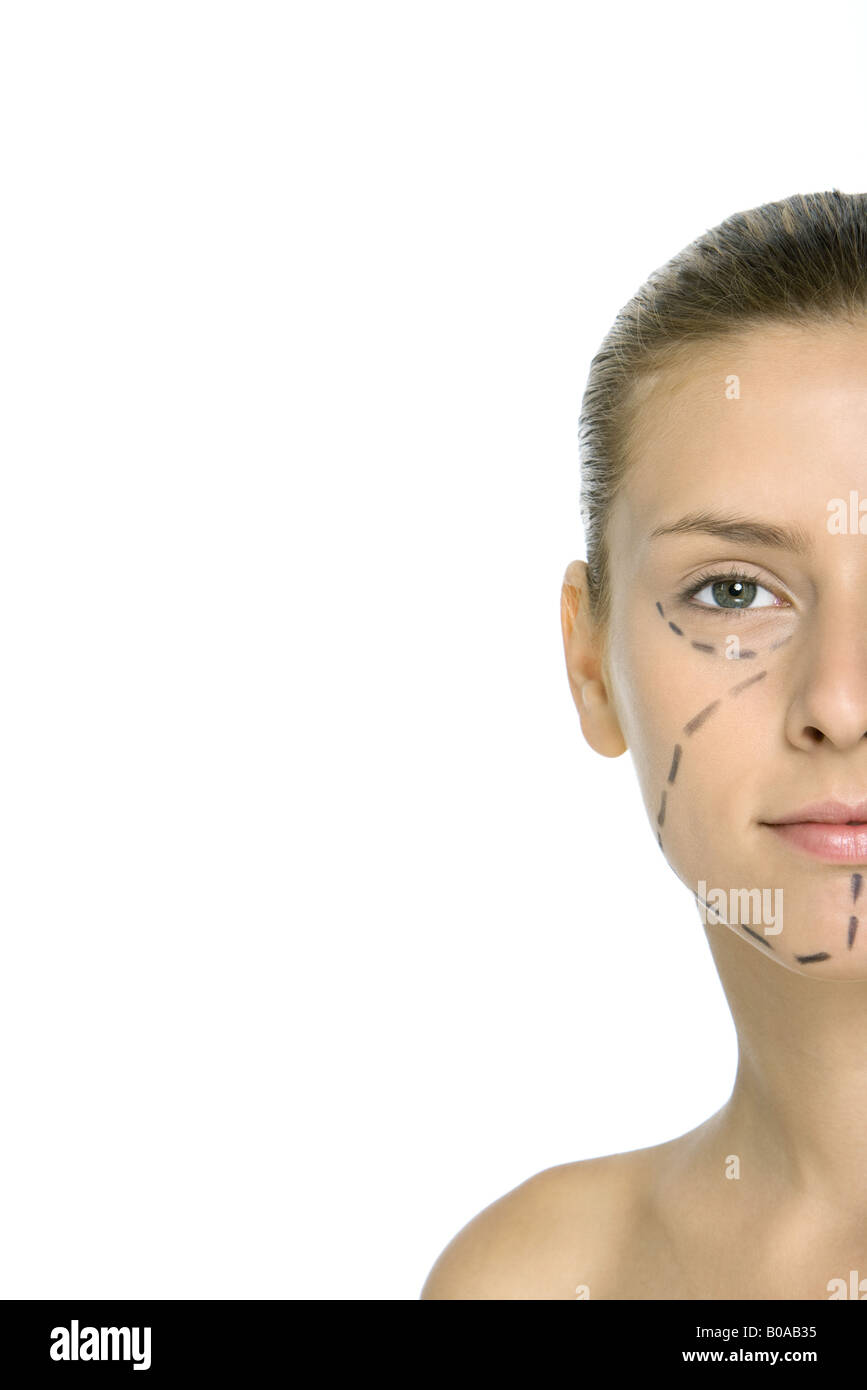 Woman with plastic surgery markings on face, looking at camera, cropped ...