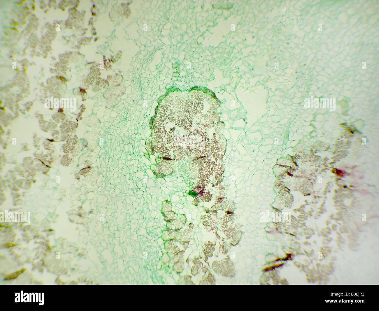 Corn Smut Microscope