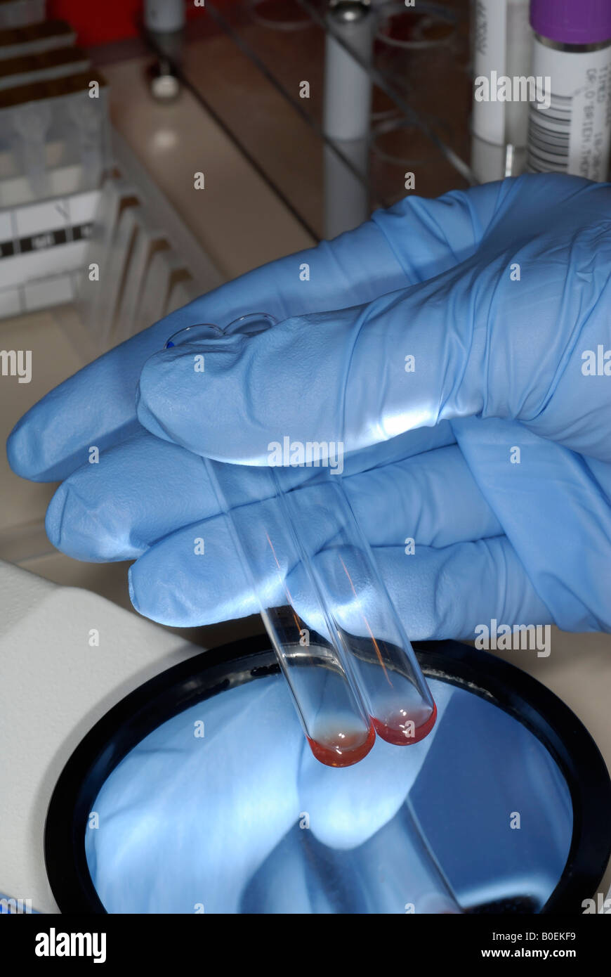 technician analyzing sample of blood in a hospital blood bank ...
