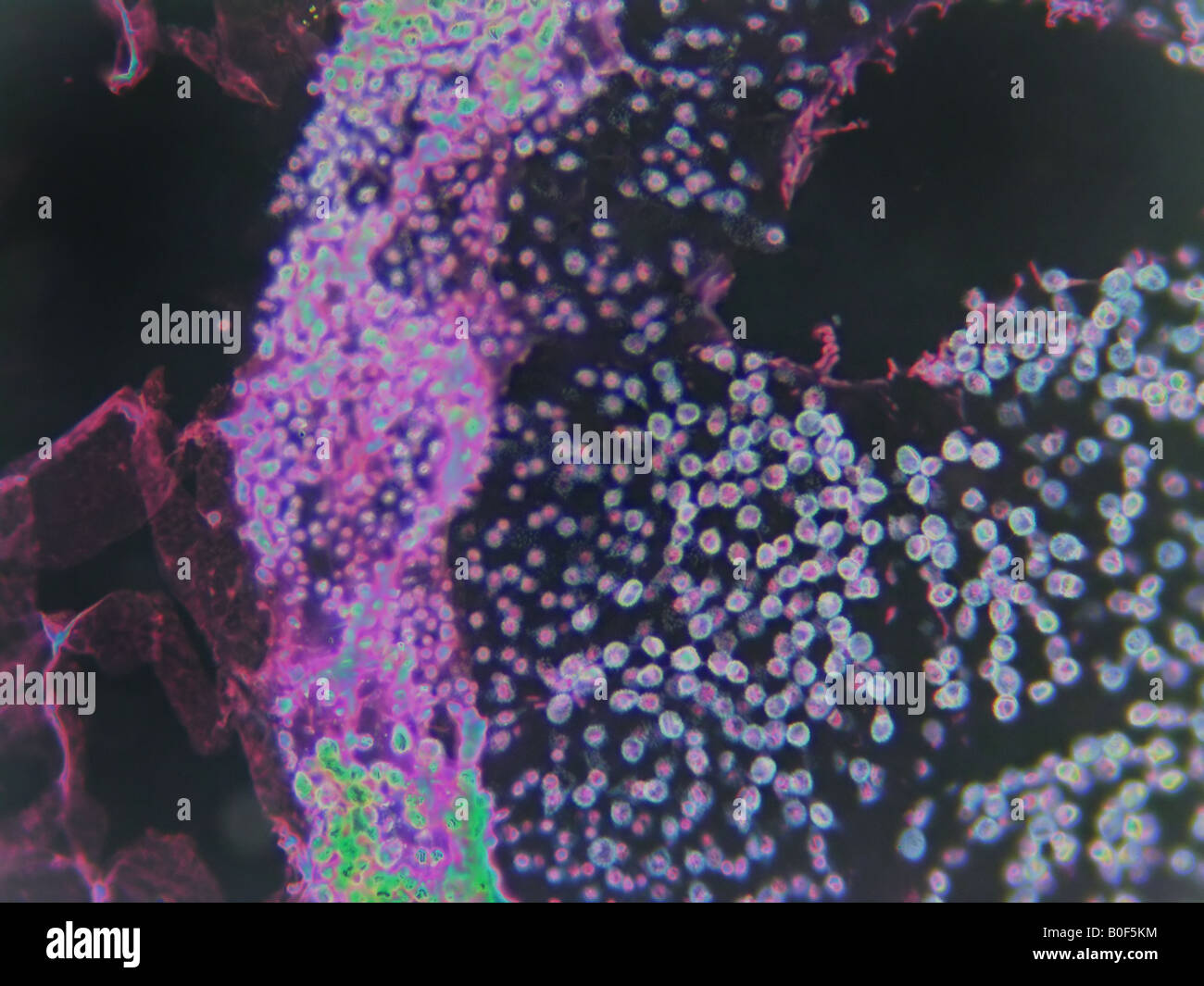 A high power view of a mass of Corn Smut Ustilago spores invading ...