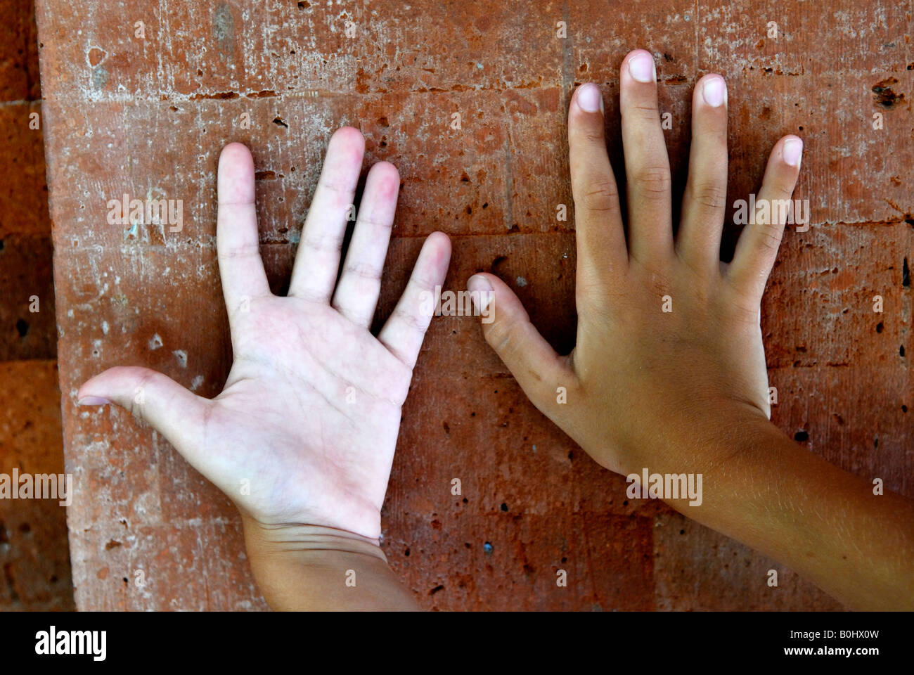 child's hands showing suntanned back of hand and very white palm Stock ...