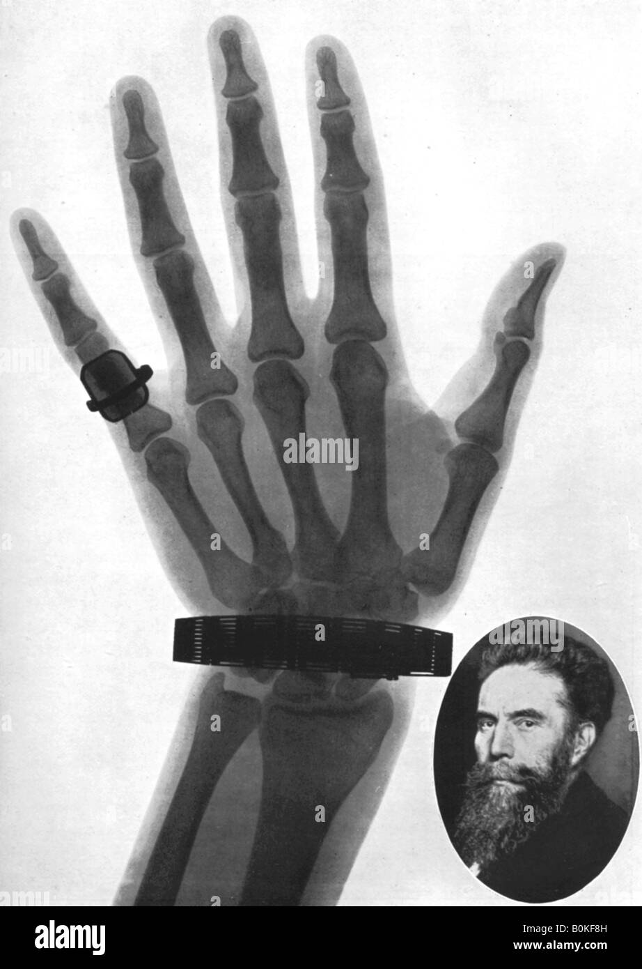 Wilhelm conrad roentgen x ray hand Black and White Stock Photos ...