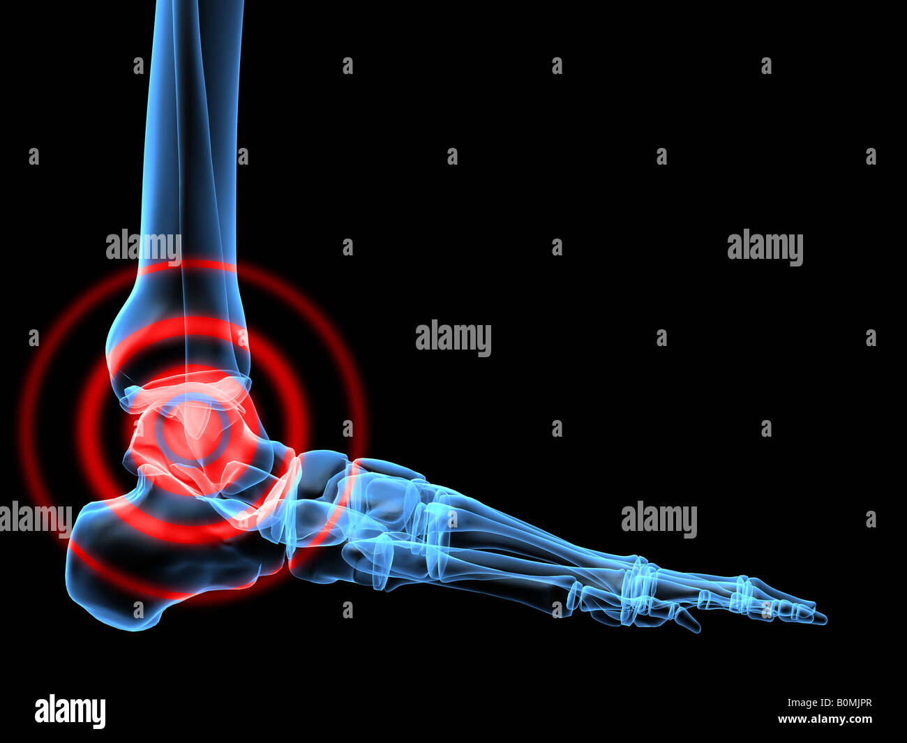 Ankle cartilage hi-res stock photography and images - Alamy