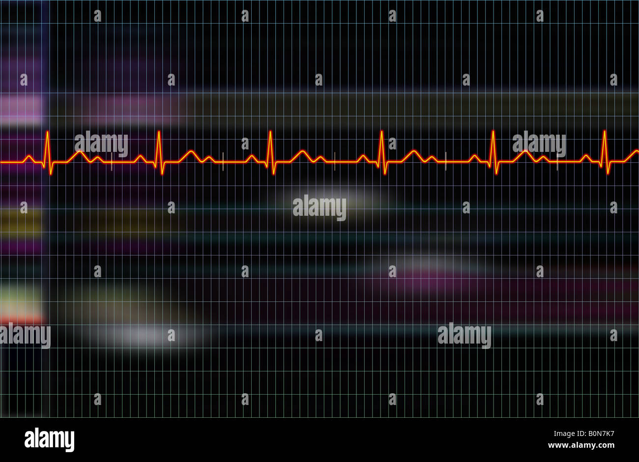 Electrocardiogram conceptual background Stock Photo - Alamy