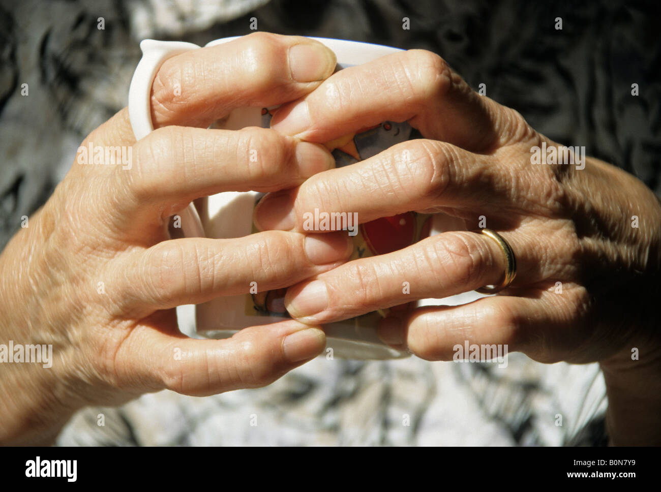 Rheumatoid arthritis hands hi-res stock photography and images - Alamy