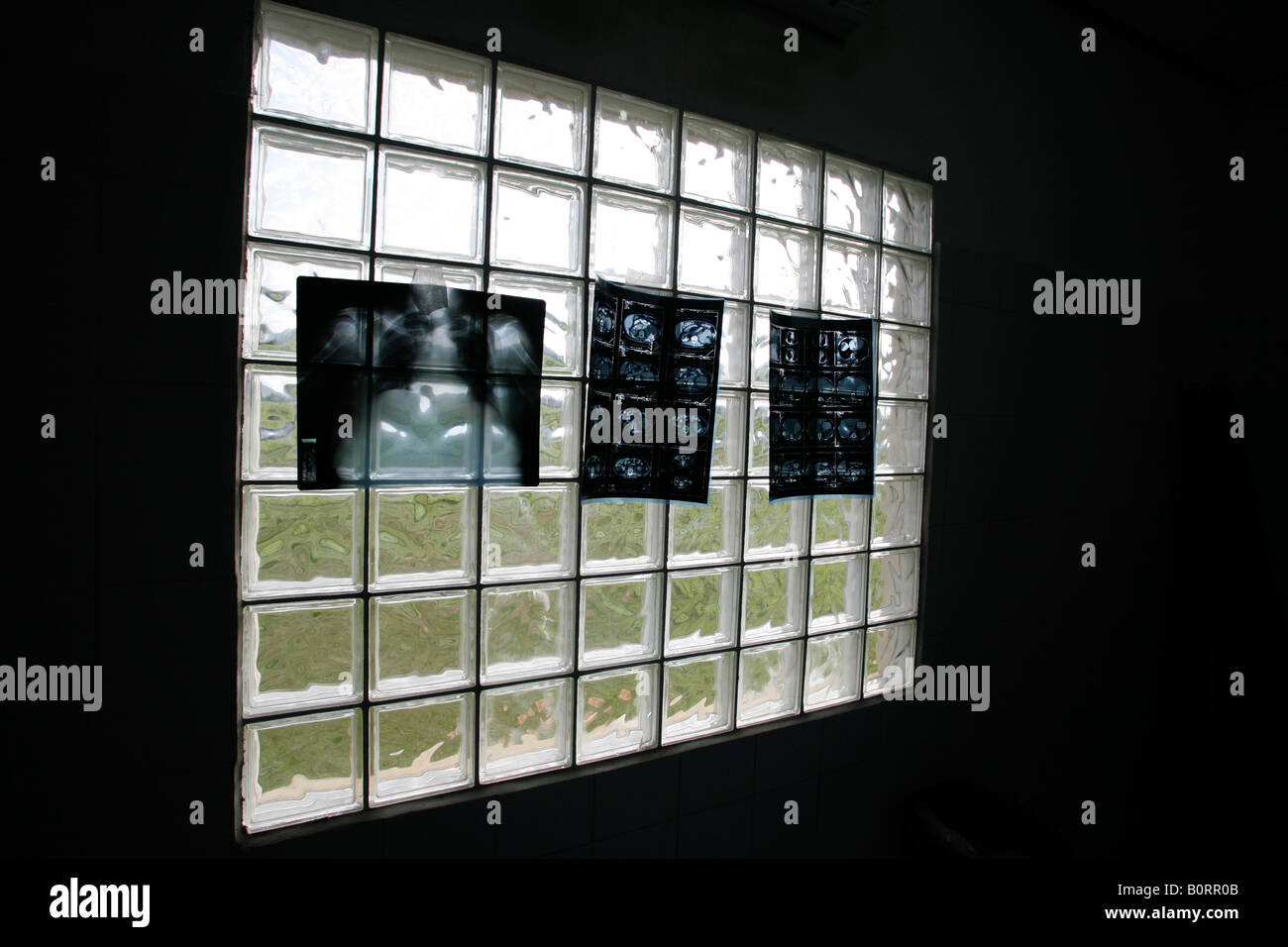 X rays in the window of an operating room during a 2006 surgical ...