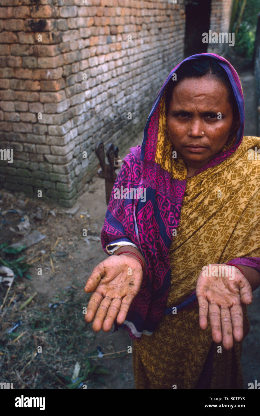Arsenic poisoning hi-res stock photography and images - Alamy