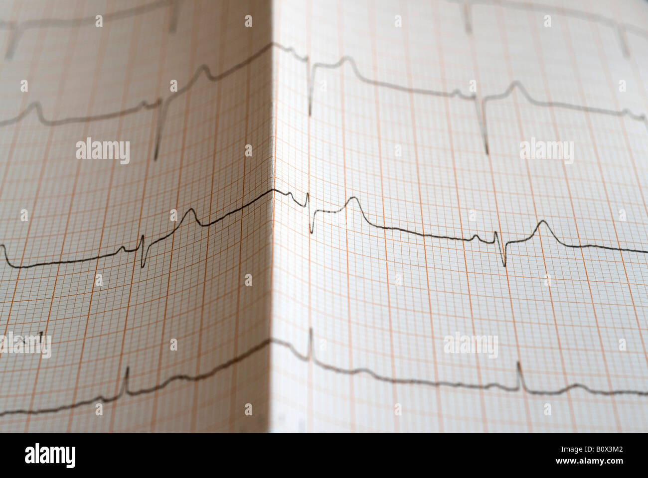Electrocardiogram procedure hi-res stock photography and images - Alamy