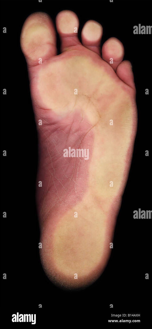 Pressed foot hi-res stock photography and images - Alamy