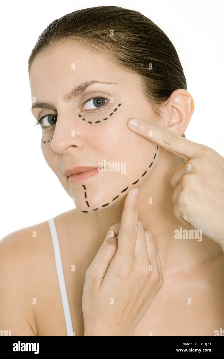 Woman pointing at plastic surgery markings on face, looking at camera ...