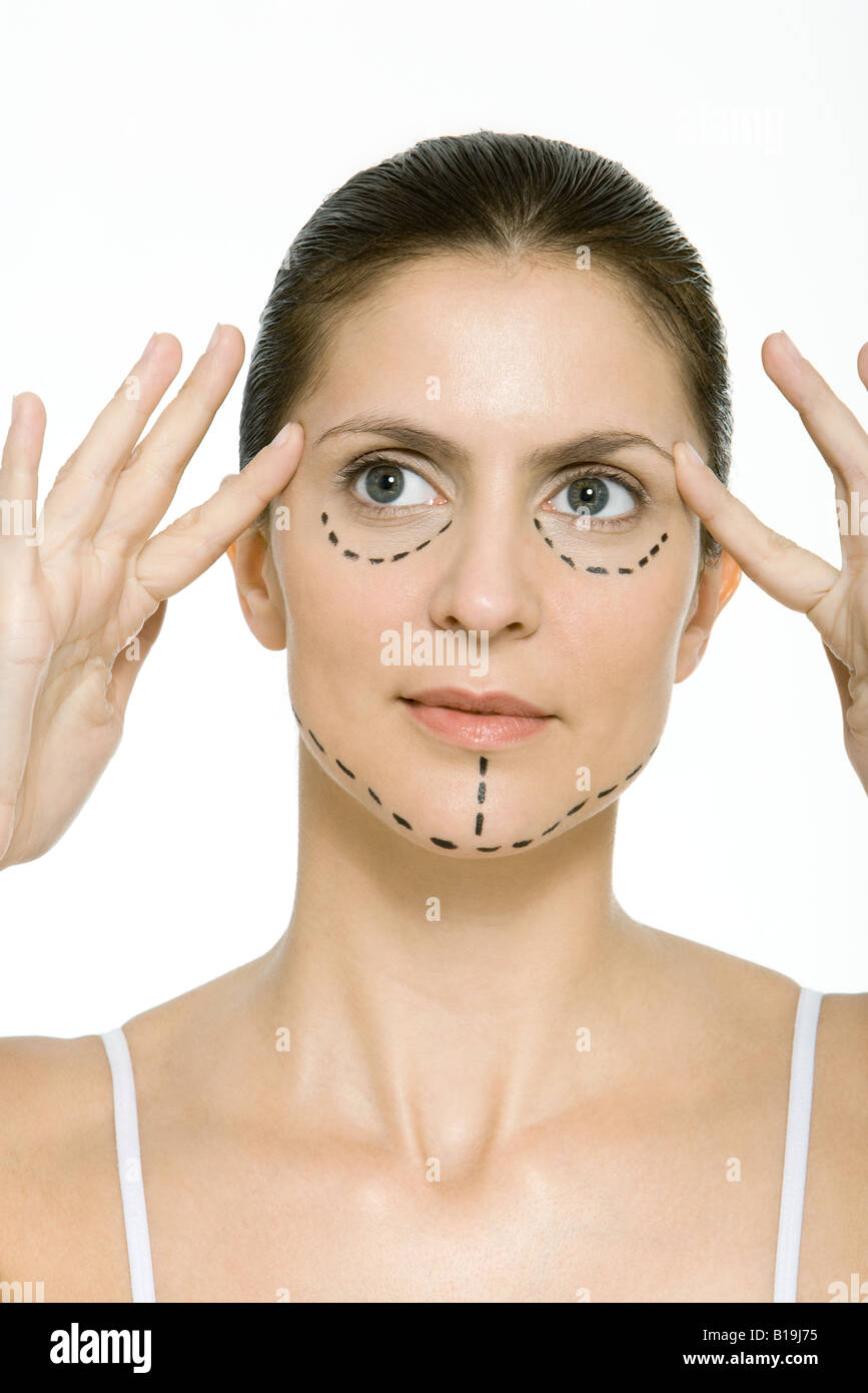Woman with plastic surgery markings on face, holding temples, looking ...