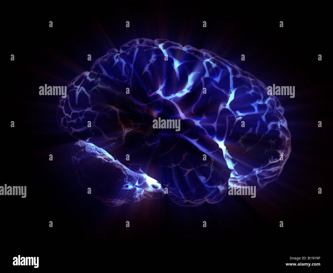The Brain Hard at Work Stock Photo - Alamy