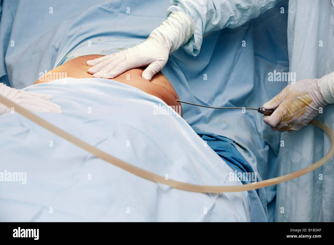 Medical surgery photos hi-res stock photography and images - Alamy