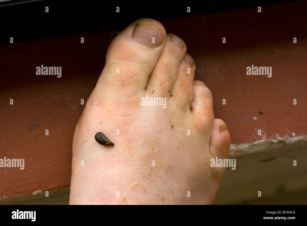 A leech sucks blood from a foot Stock Photo - Alamy