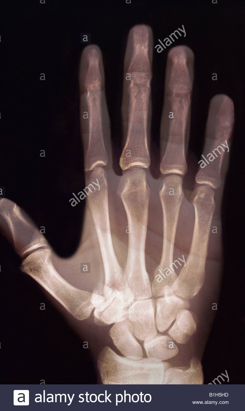 Skeleton Hand Stock Photos & Skeleton Hand Stock Images - Alamy
