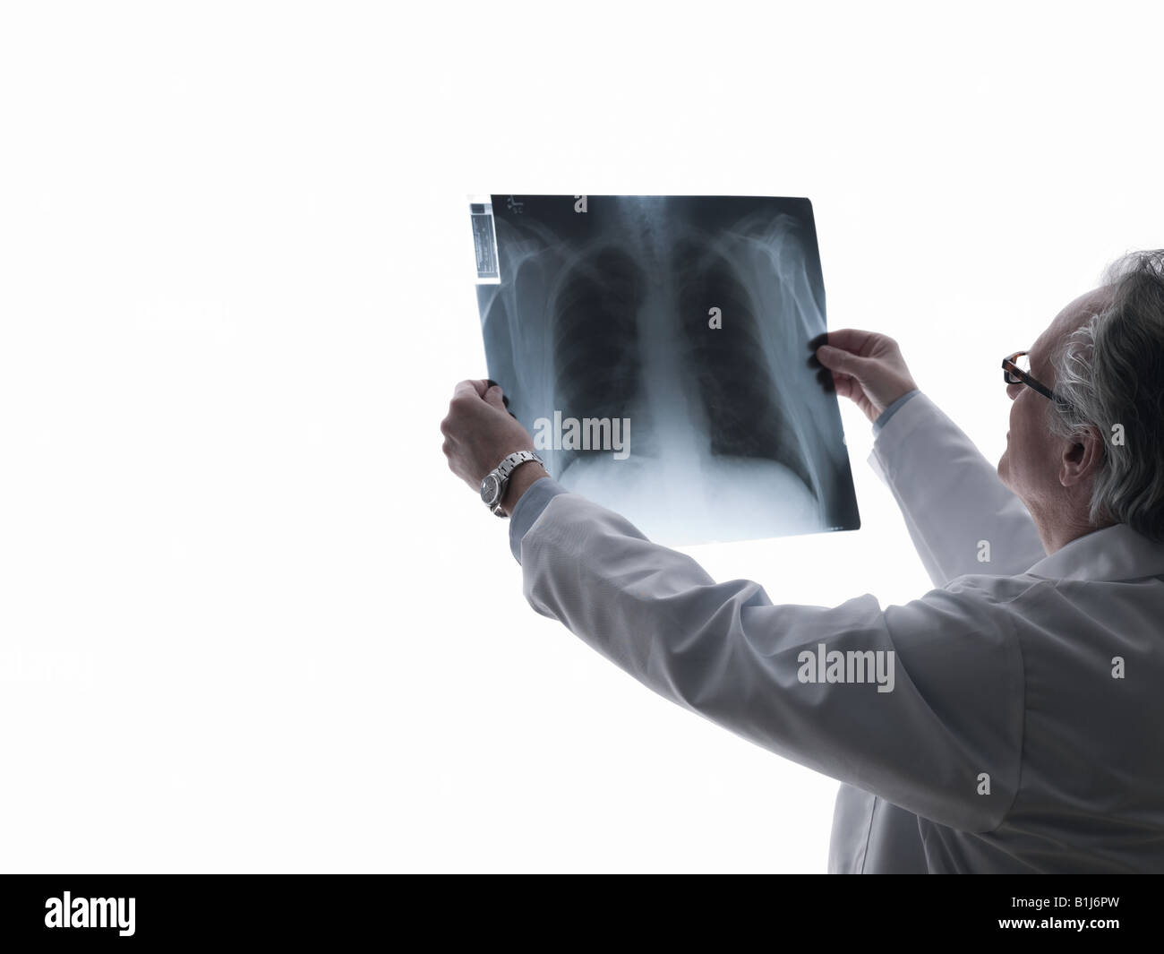 Doctor looking at an x-ray Stock Photo - Alamy