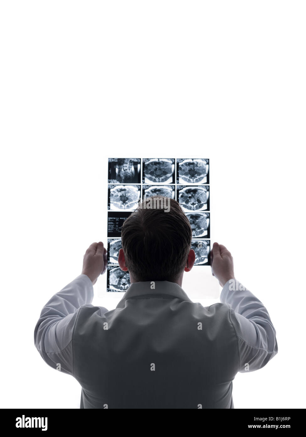 Doctor with mri scan Stock Photo - Alamy