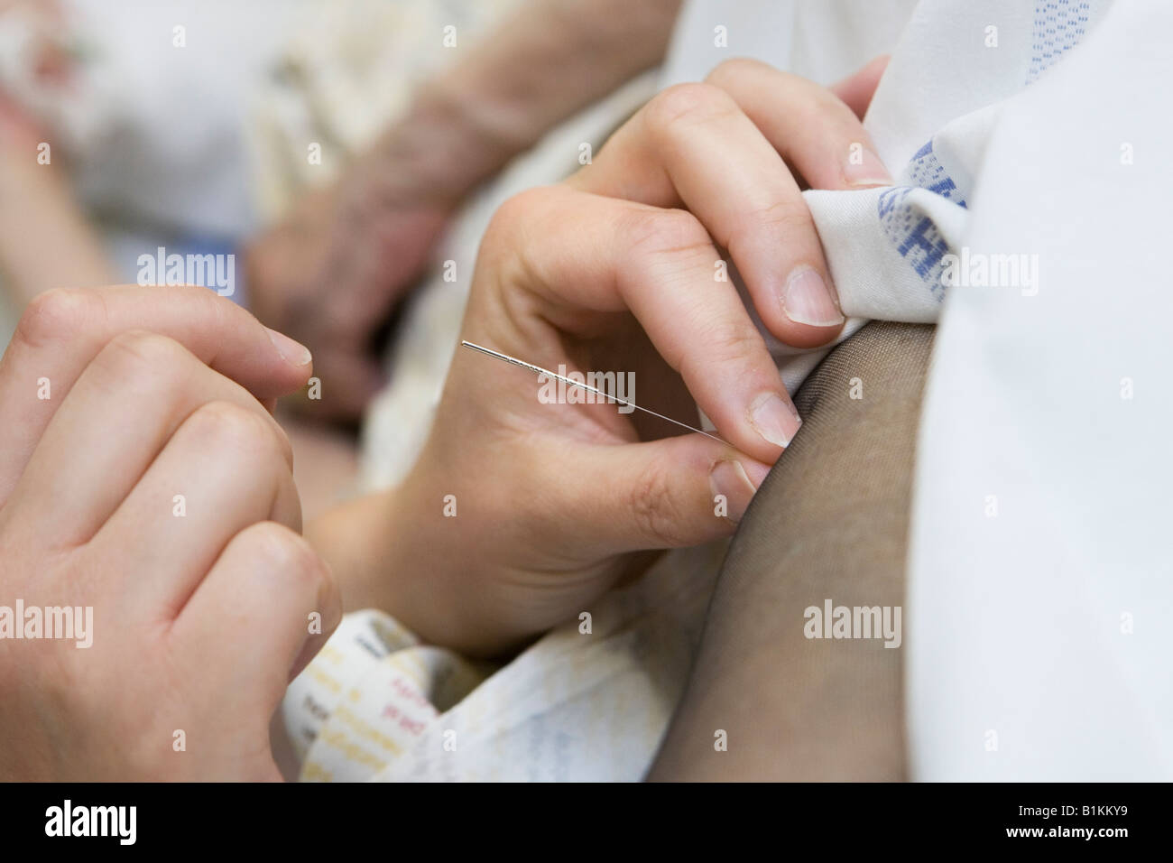 Patient receiving acupuncture treatment to her leg Stock Photo - Alamy