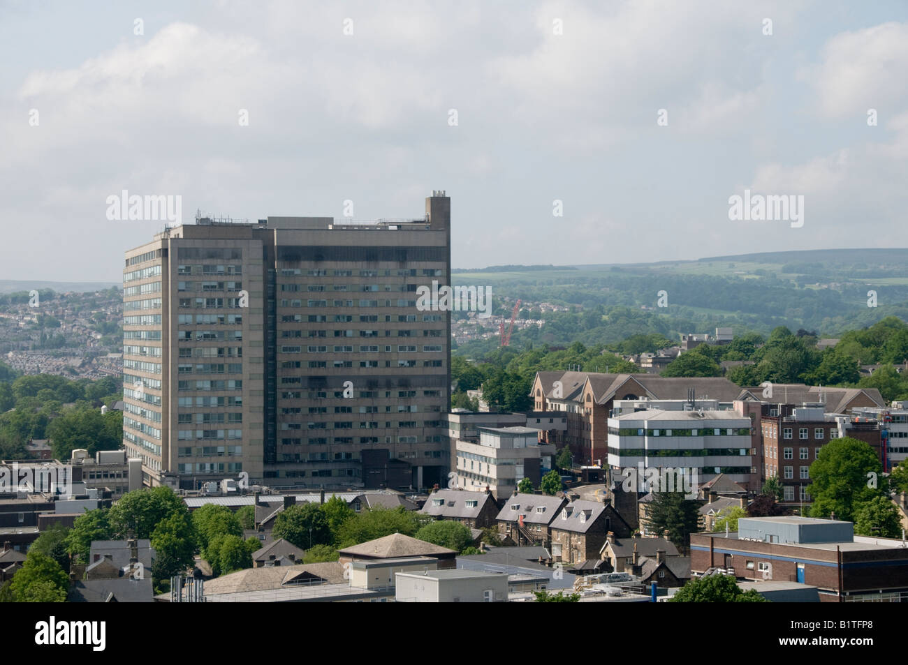 Hallamshire Hospital Sheffield City Centre South Yorkshire England ...