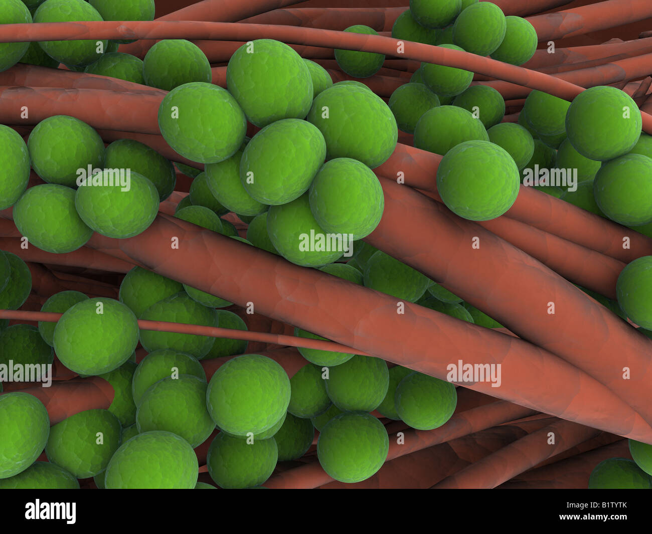 Staphylococcus infection hi-res stock photography and images - Alamy