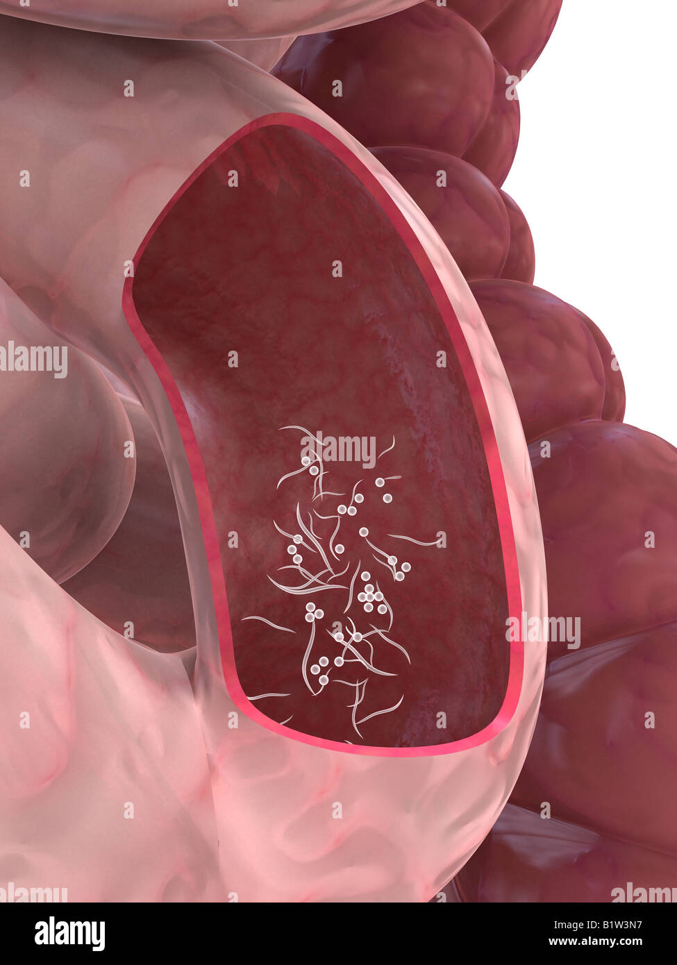 Pinworm disease hi-res stock photography and images - Alamy