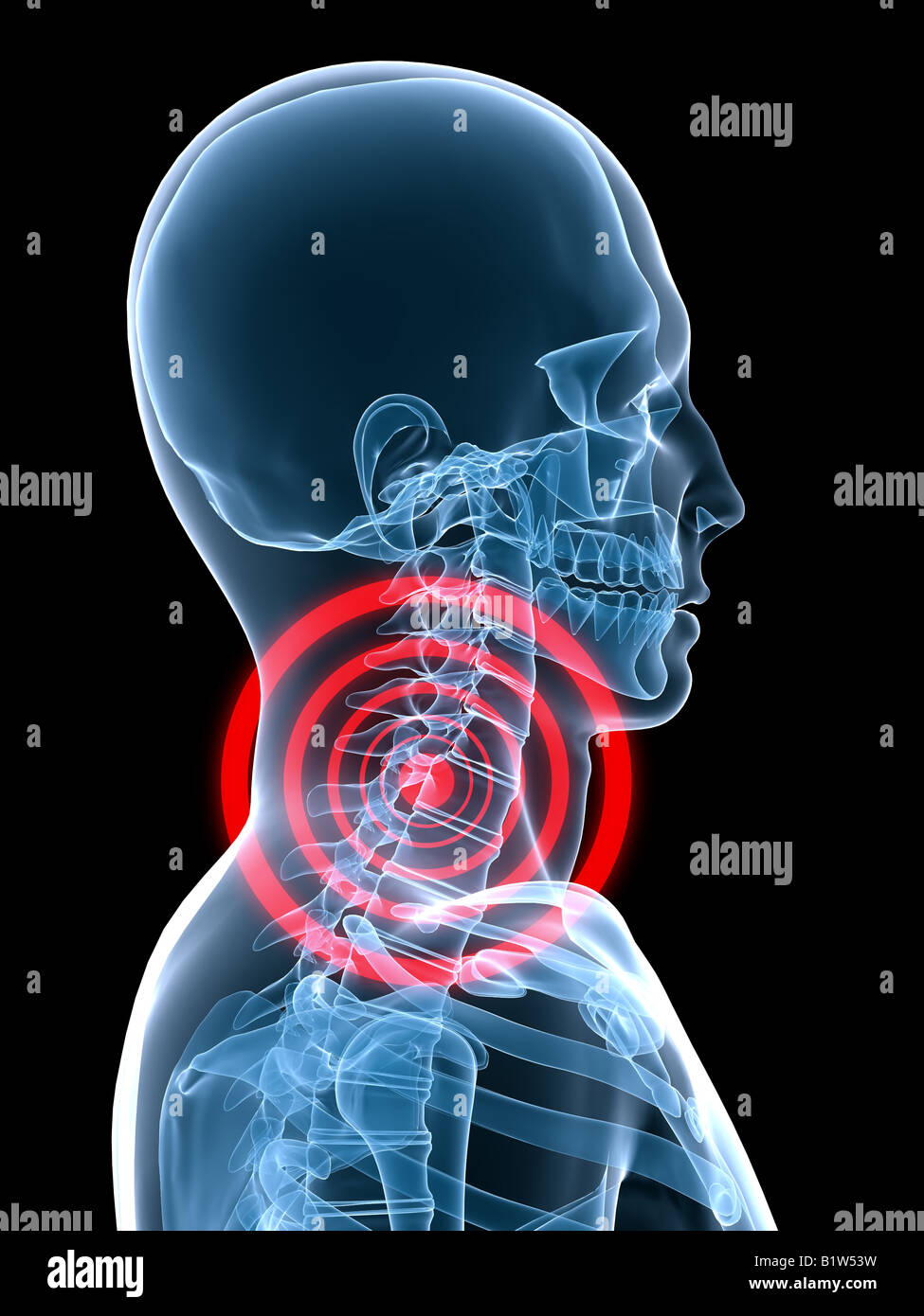 Painful spine hi-res stock photography and images - Alamy