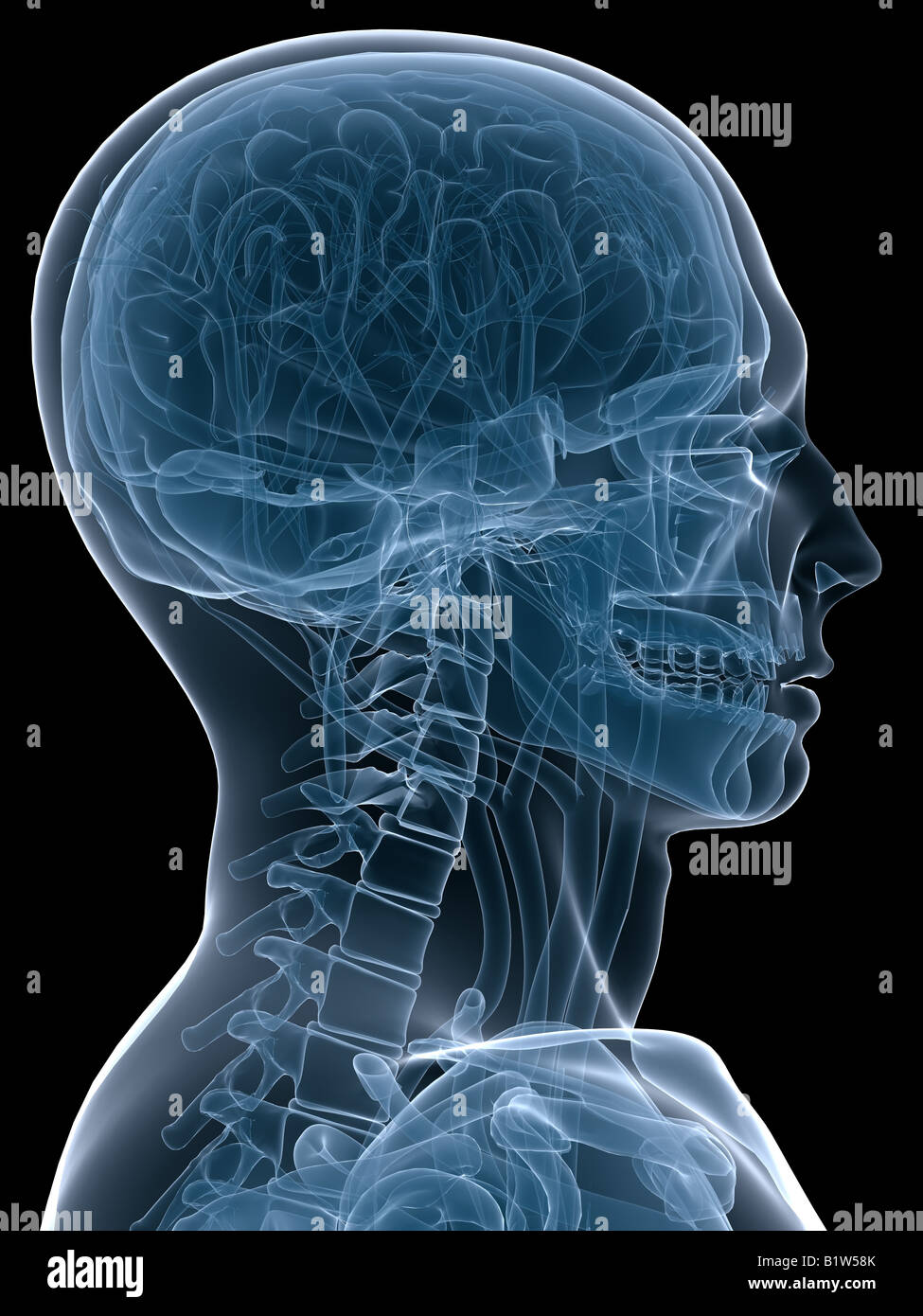 x-ray head with brain Stock Photo - Alamy