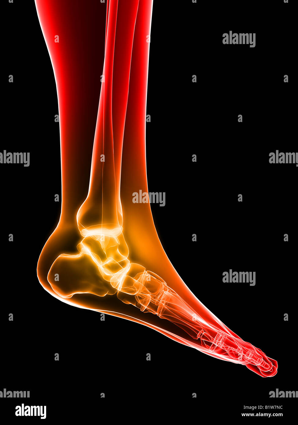 X ray of ankle hi-res stock photography and images - Alamy