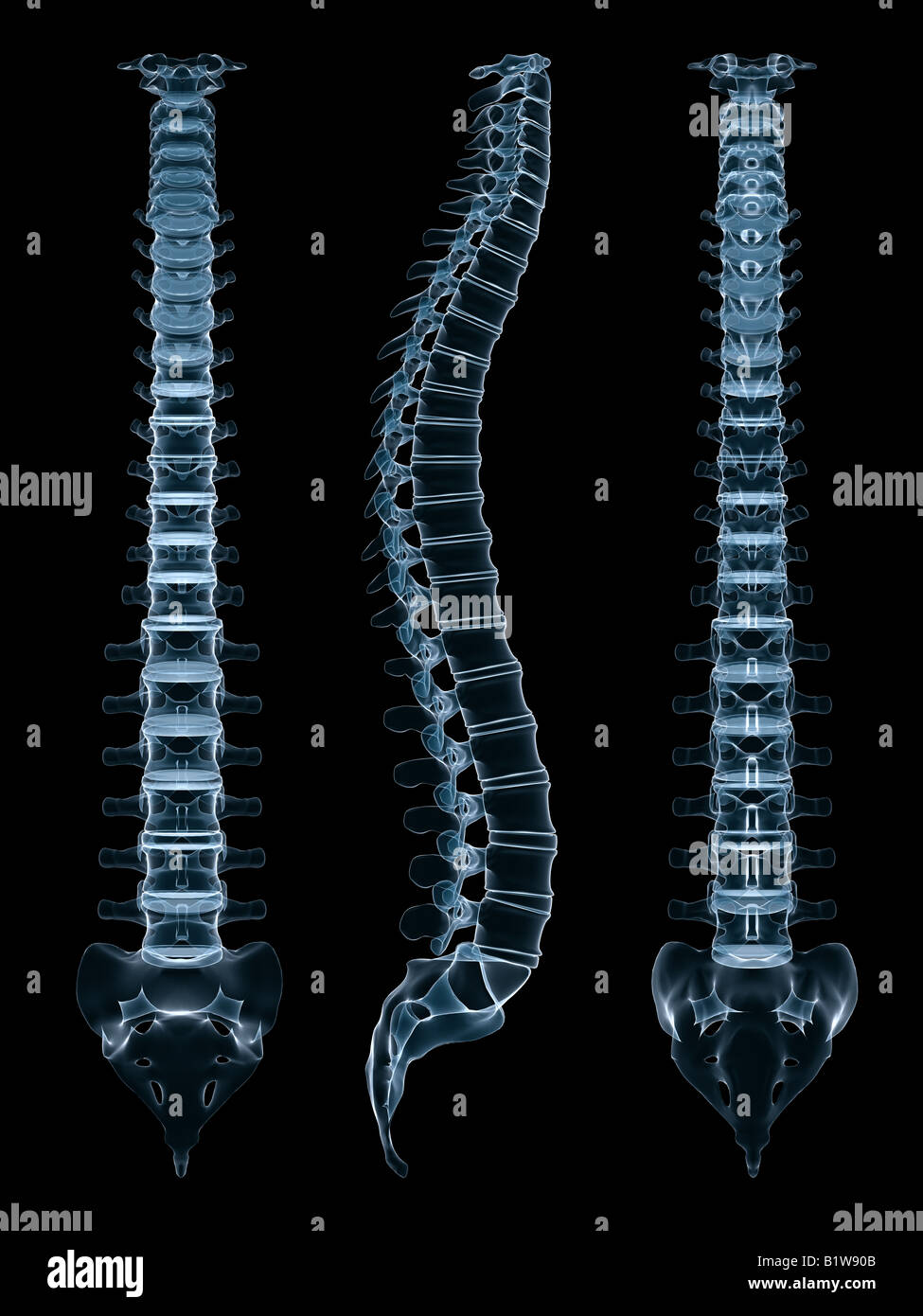 Spine x ray hi-res stock photography and images - Alamy