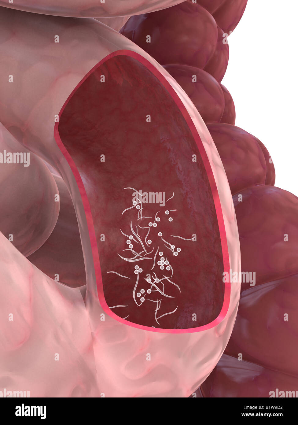 Pinworms hi-res stock photography and images - Alamy