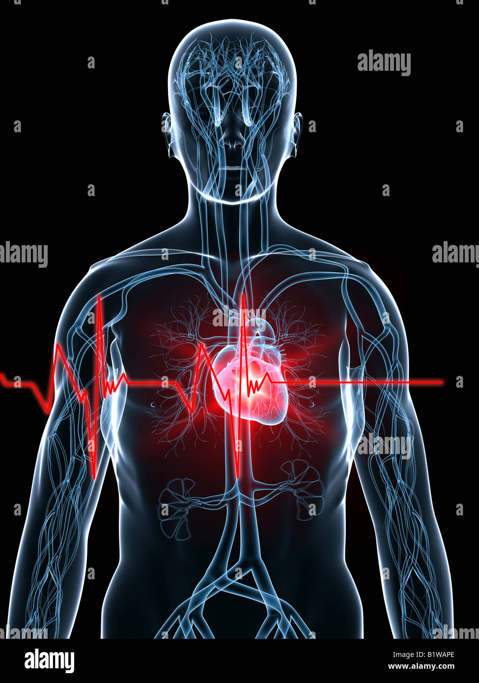 Heartbeat heartattack hi-res stock photography and images - Alamy