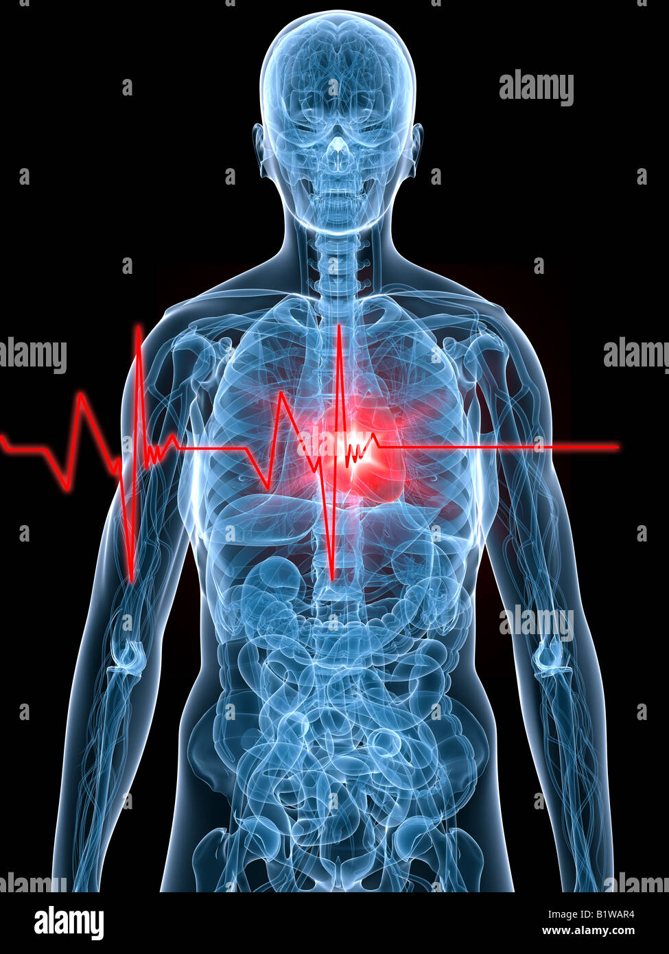 Heartbeat heartattack hi-res stock photography and images - Alamy